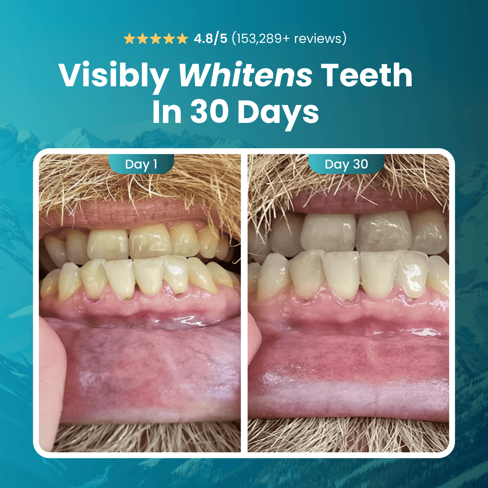 Larineco™️ Remineralizing Toothpaste for Stronger Teeth